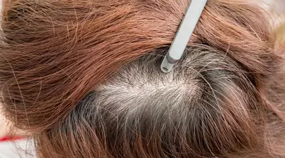 Părul alb, indicator al stării de sănătate | Unica.ro