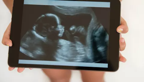 Pozitionarea copilului inainte de nastere. Ce probleme pot sa apara