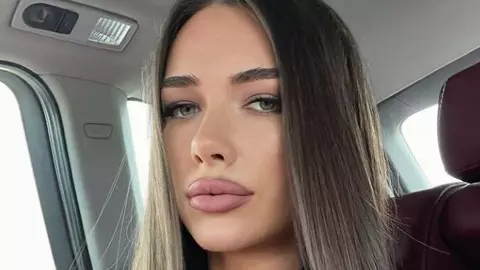 Imagini cu Iustina Loghin de la Insula iubirii înainte de operațiile estetice. Cum arăta concurenta