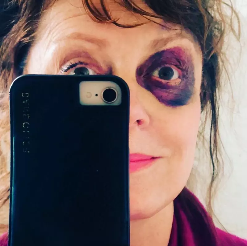 Susan Sarandon, grav accidentată! Contuzie, nas fracturat, genunchi rănit